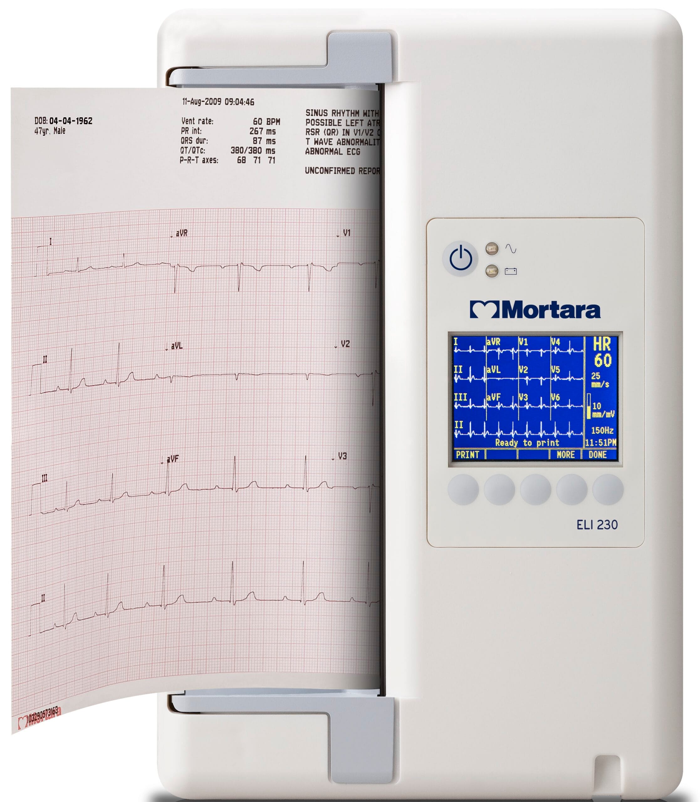 ECG inimă - Diagnostic aritmii & tahicardie | Clinica Fortius Medical